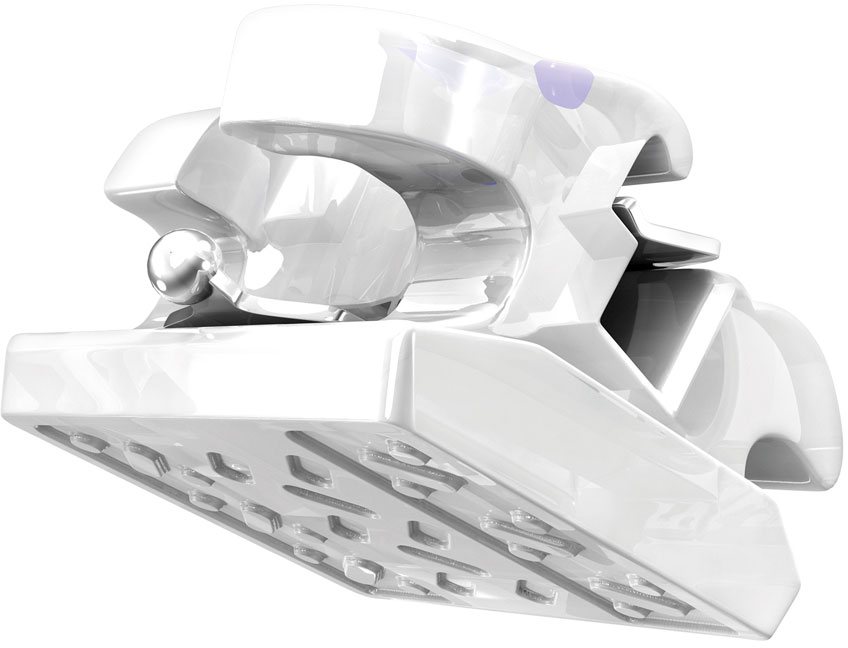 Experience C - Aesthetic Bracket Systems - TOC Dental
