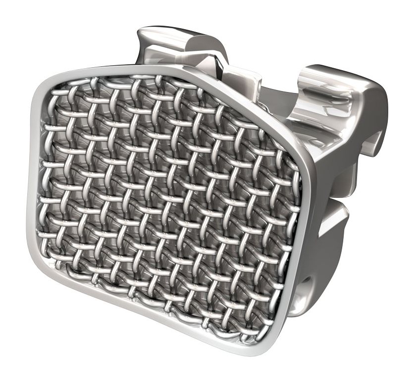 Experience Metal - Metal Bracket Systems - TOC Dental