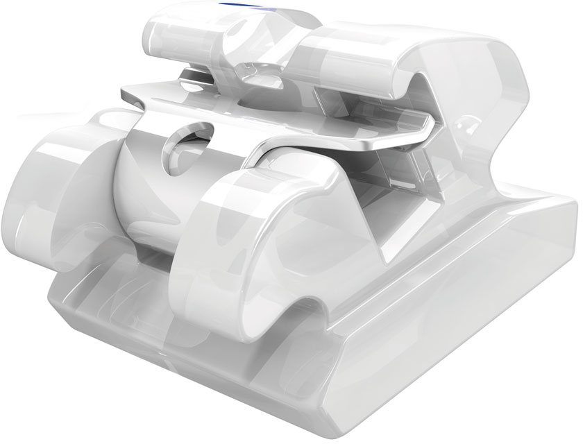 Experience C Bracket Kits - Aesthetic Bracket Systems - TOC Dental