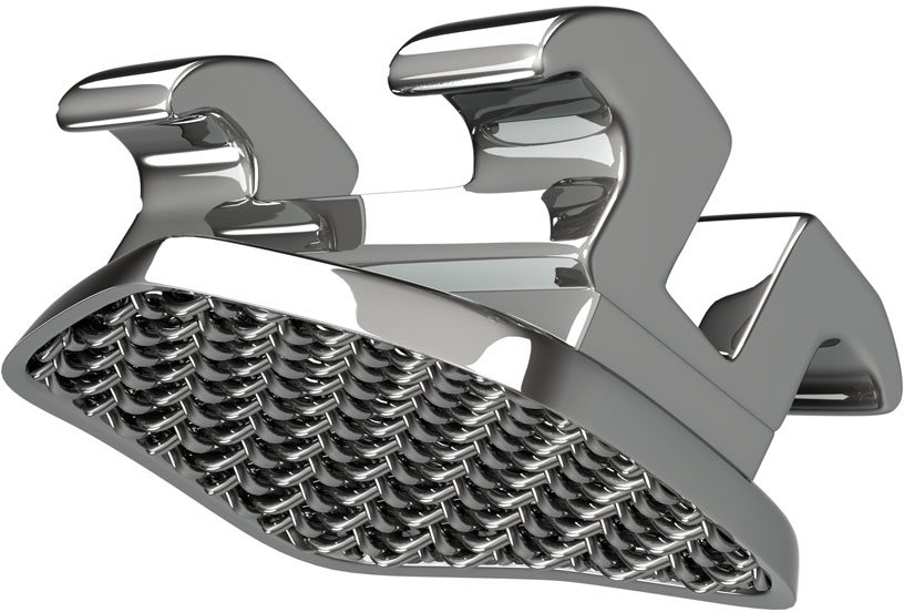 Legend Medium Brackets - Metal Bracket Systems - TOC Dental