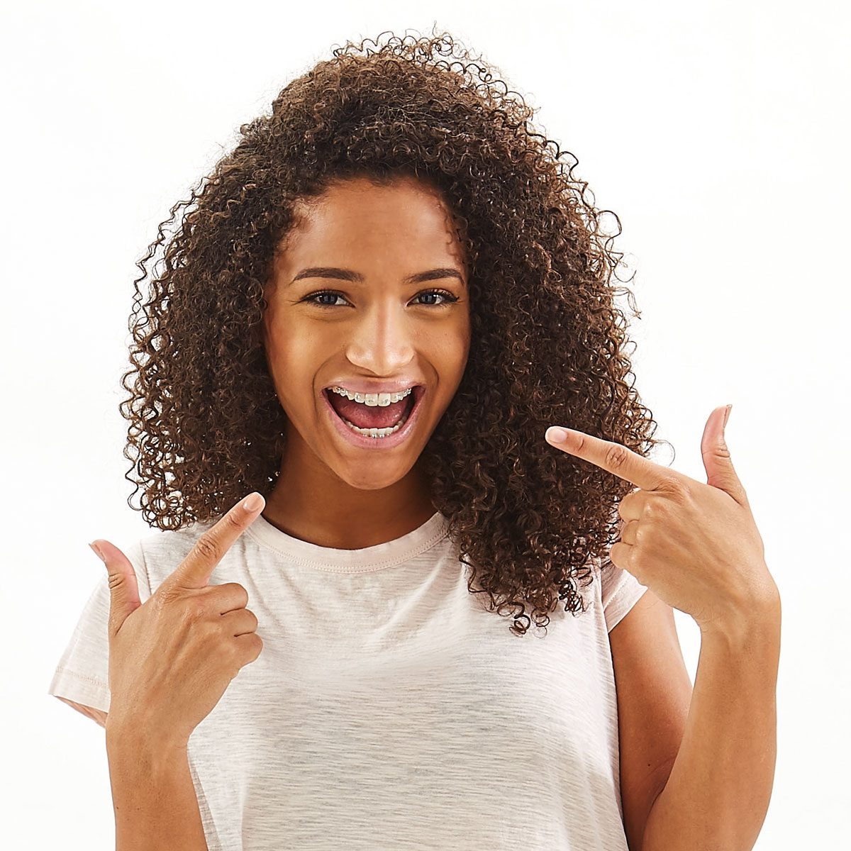 Legend Mini Rhodium Aesthetic Brackets - Aesthetic Bracket Systems ...