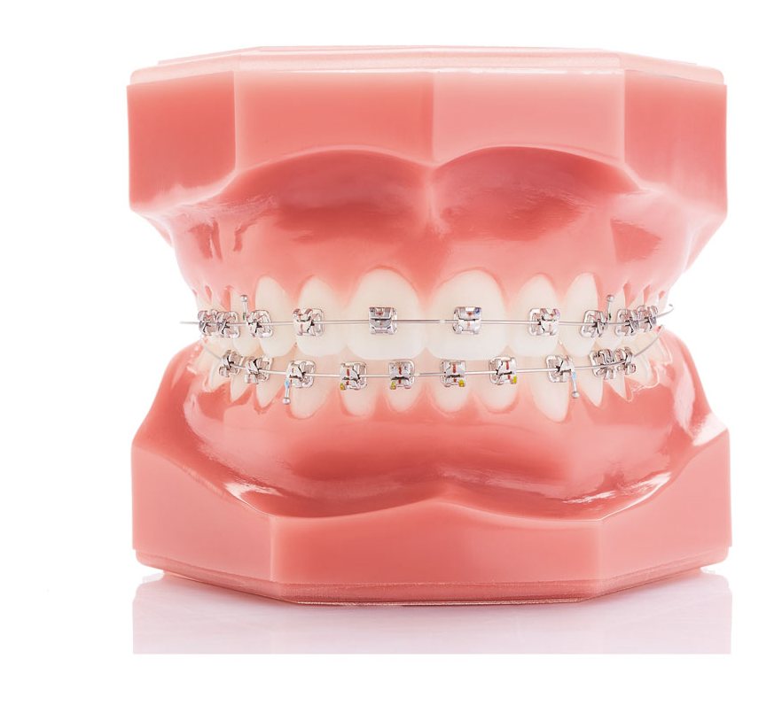 Legend Mini Rhodium Consultation Model - Consultation Models - TOC Dental
