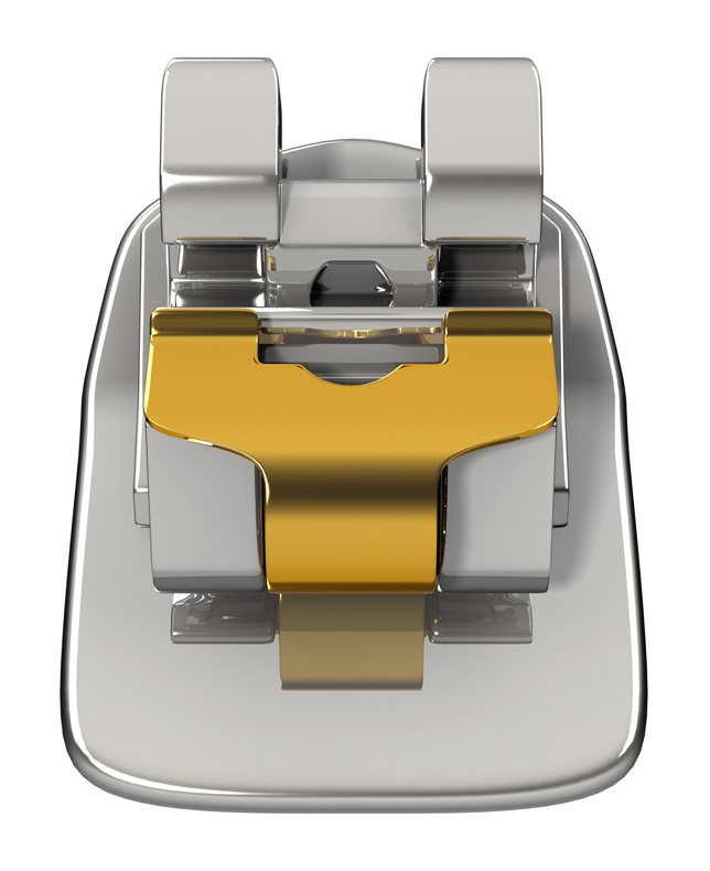 Experience L Brackets - Self Ligating Bracket Systems - TOC Dental