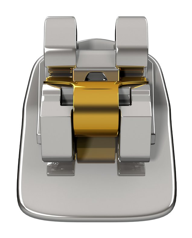 Experience L Brackets - Self Ligating Bracket Systems - TOC Dental