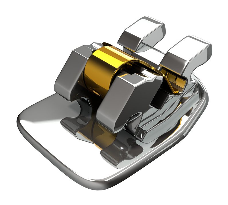 Experience L Brackets - Self Ligating Bracket Systems - TOC Dental