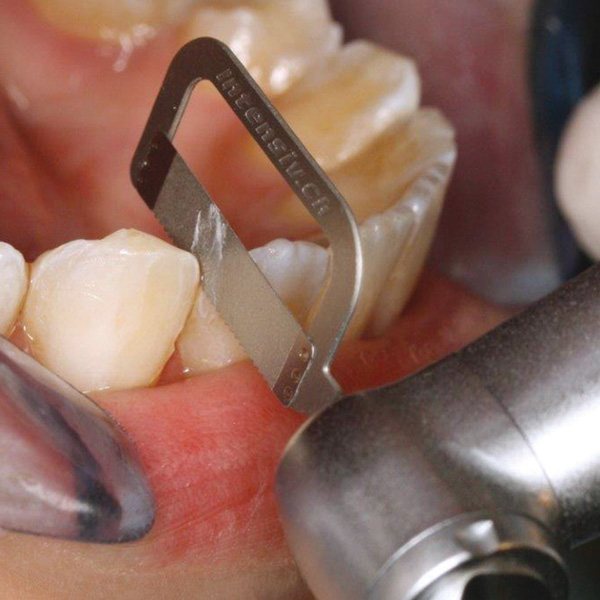 Swingle Ortho Professional Kit - IPR Kits - TOC Dental