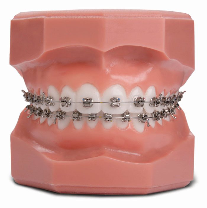 In-Ovation R Consultation model - Consultation Models - TOC Dental