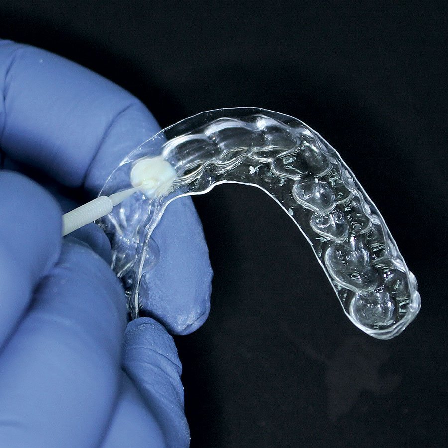 Reliance Perfect-A-Smile Pontic Paint - Bonding and Attachments - TOC ...