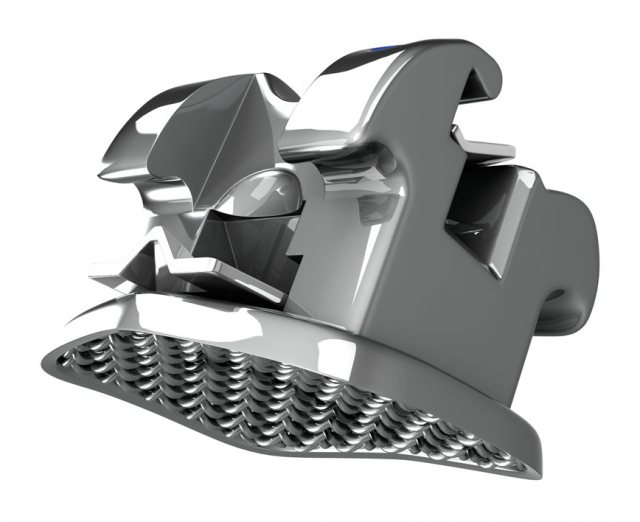 Experience Metal - Metal Bracket Systems - TOC Dental