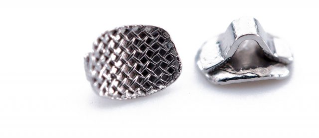 Bondable Eyelets - Bondable Attachments - TOC Dental