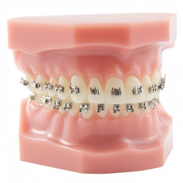 Essentials Individuals - Metal Bracket Systems - TOC Dental