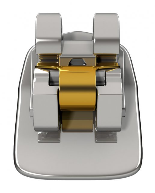 Experience L Brackets - Self Ligating Bracket Systems - TOC Dental