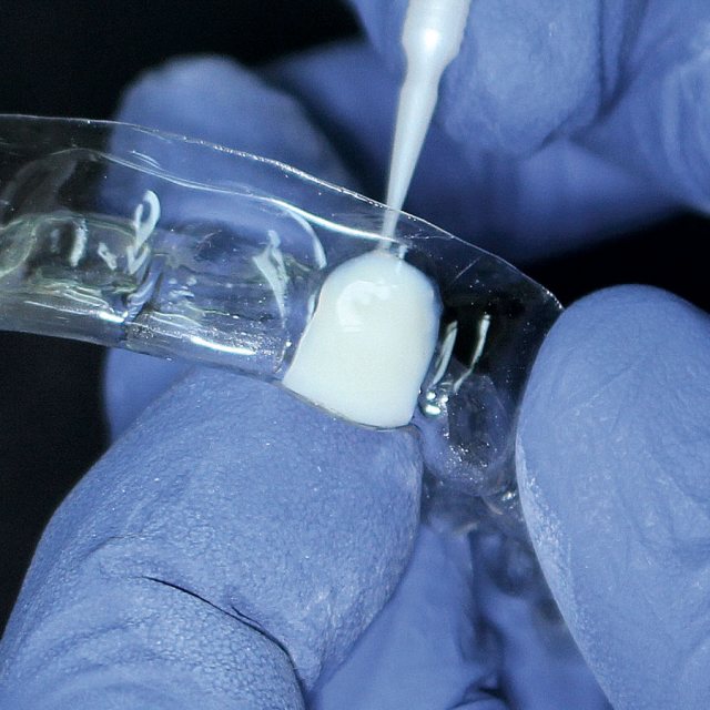 Reliance Perfect-A-Smile Pontic Paint - Bonding and Attachments - TOC ...